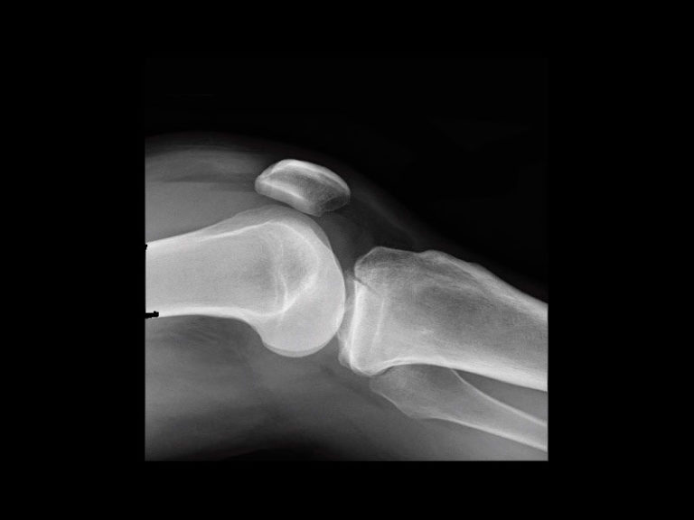 Clinical Update: Knee imaging, which test when? - Medical Forum