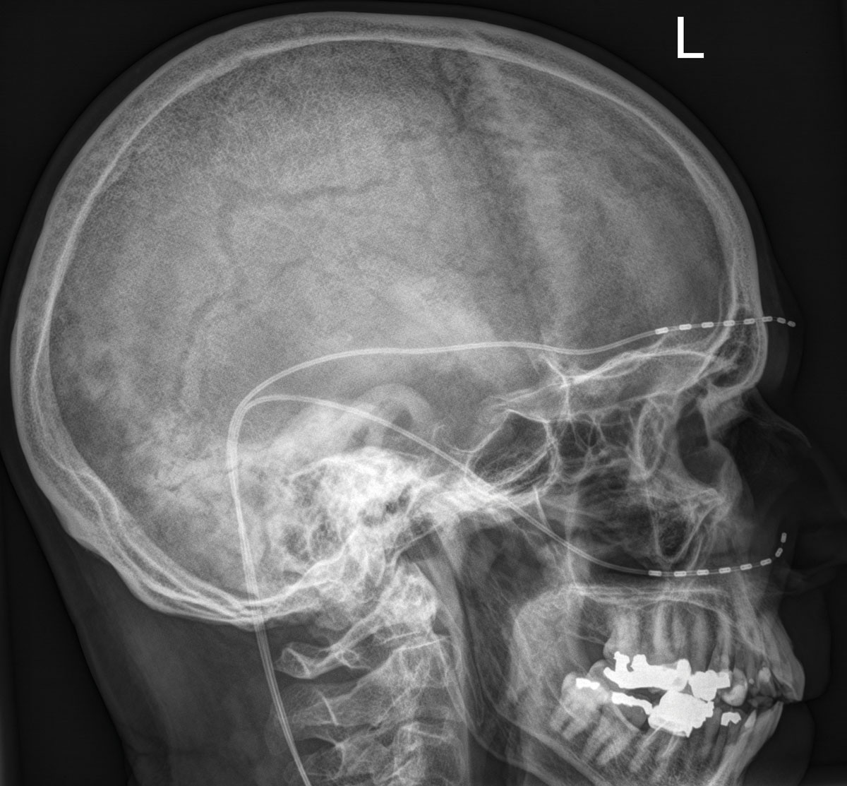 240320-Finch-article-SKULL-lateral-March-2020 - Medical Forum