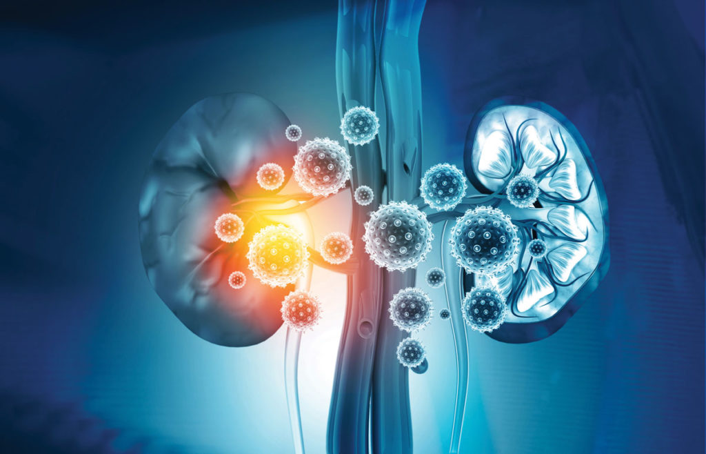 Management of diabetic chronic kidney disease - Medical Forum