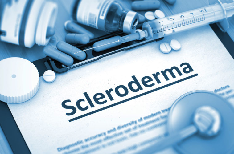 Systemic sclerosis – a team approach - Medical Forum