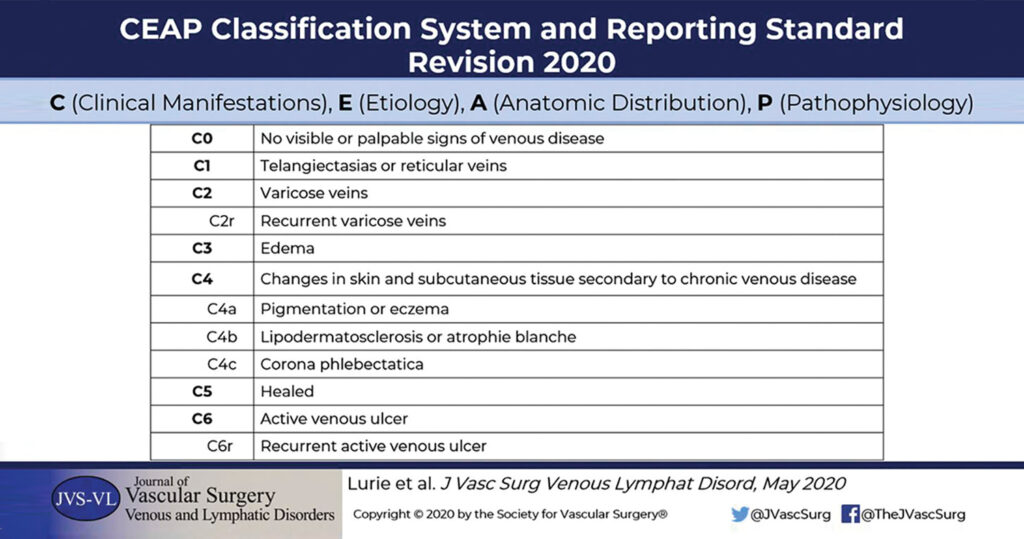 NSVT – who to treat, who should treat - Medical Forum