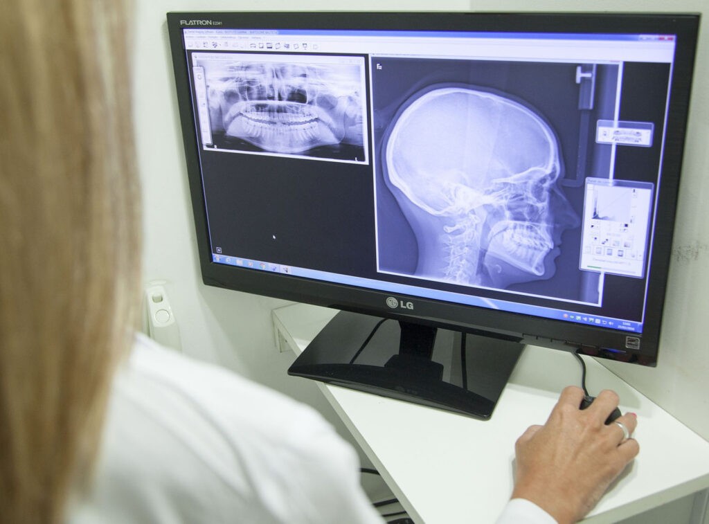 Taking x-rays in a flash - Medical Forum