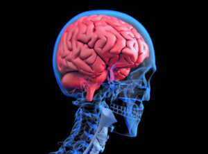 Stroke cuts life expectancy by one third - Medical Forum