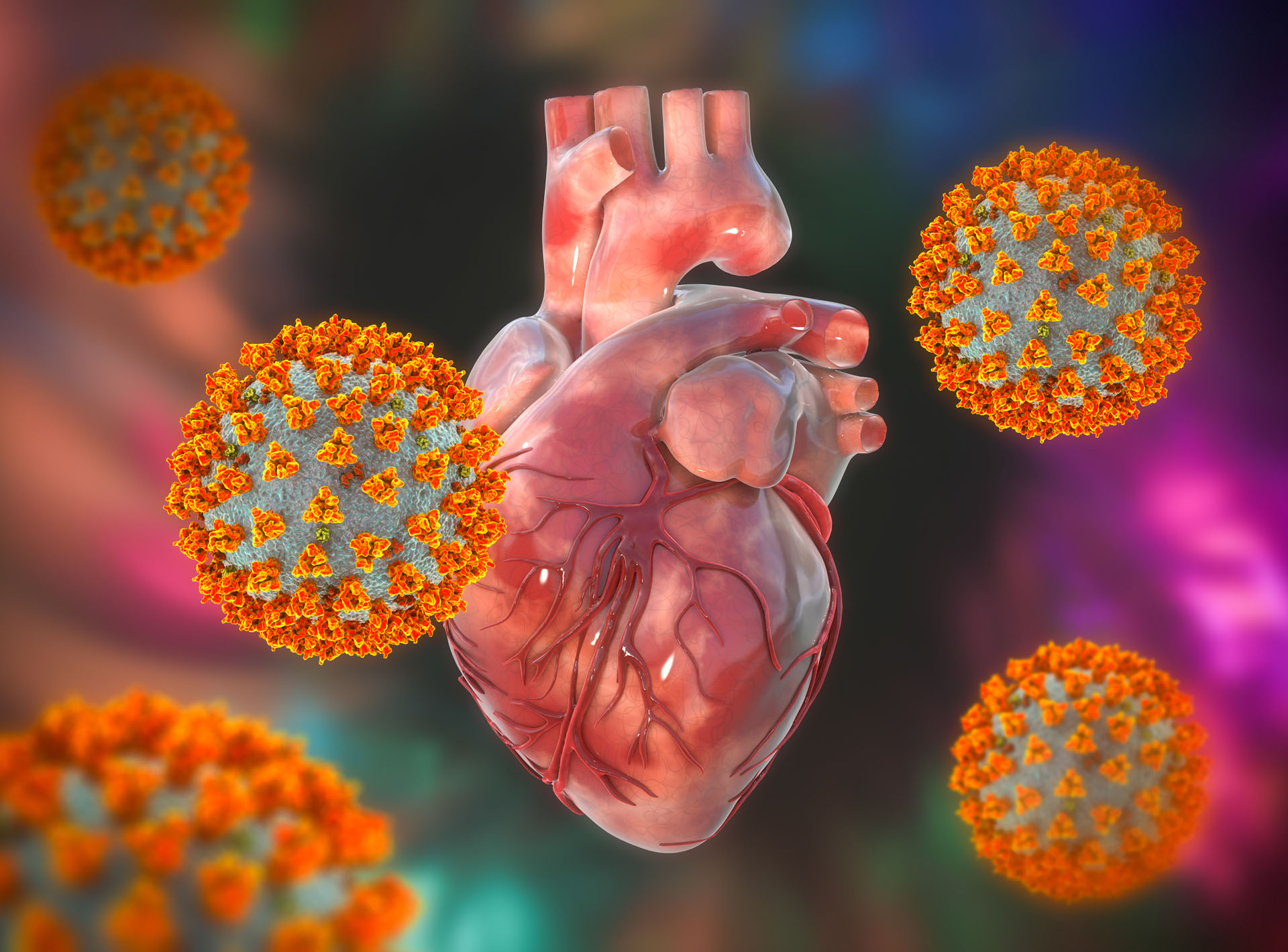 Vaccine myocarditis in Aussie teens - Medical Forum