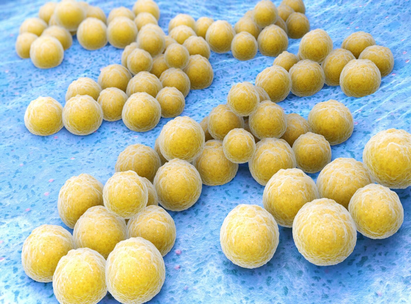 Goodbye golden staph? - Medical Forum