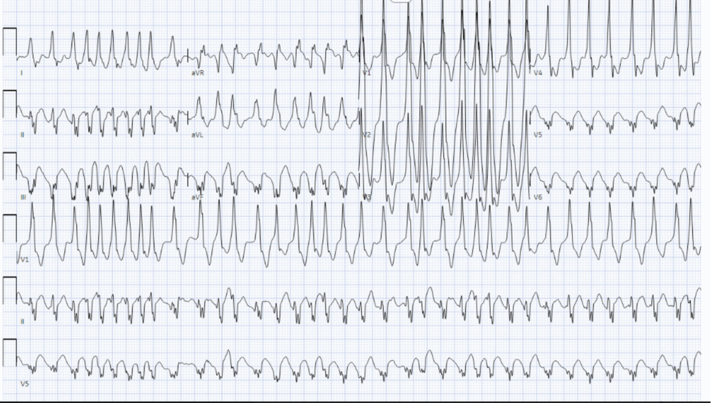 ECG Clinical Quiz – Case 3 - Medical Forum