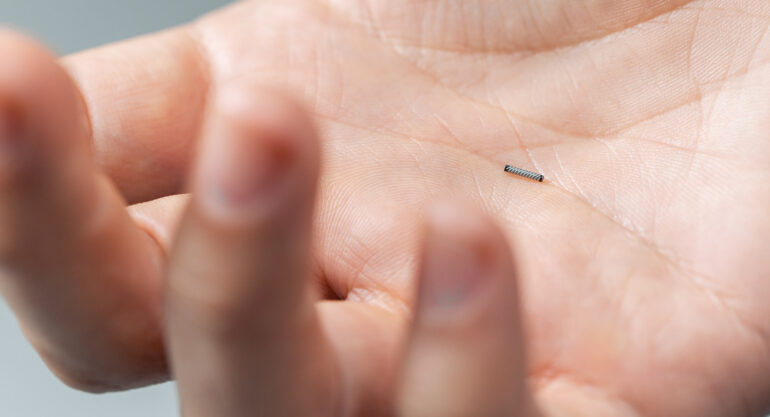 Advances in resection of impalpable breast lesions - Medical Forum