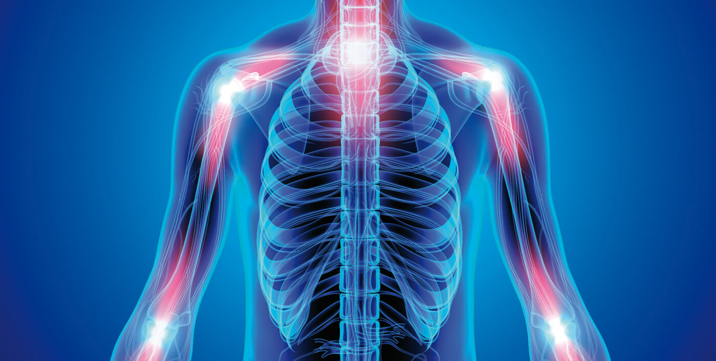 “Huge improvements” for chronic back pain sufferers - Medical Forum