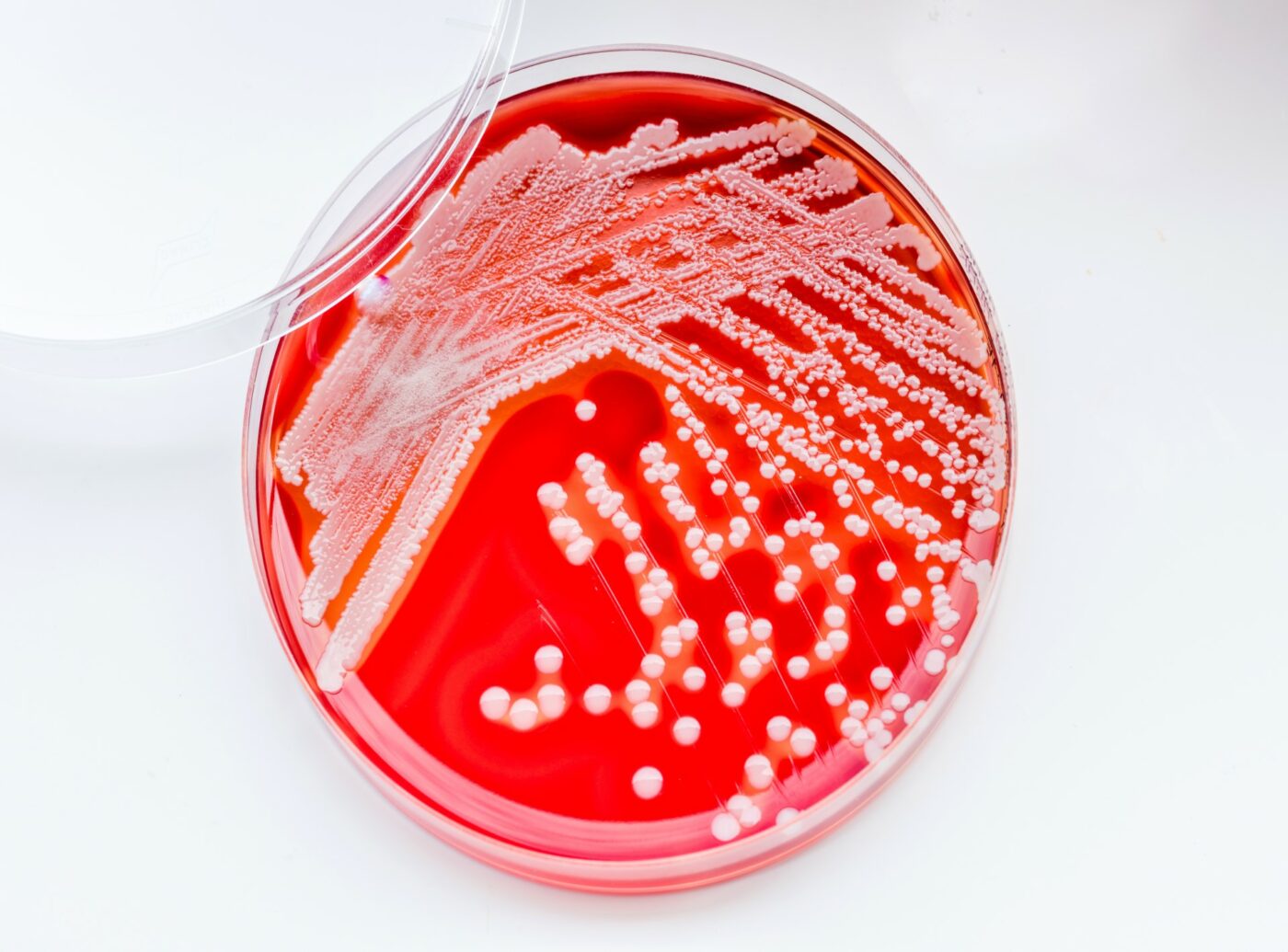 Genes for antibiotic resistance - Medical Forum
