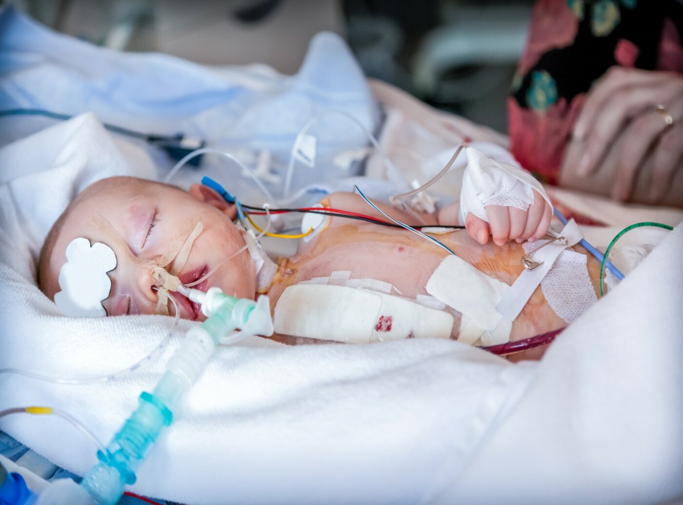 New paediatric sepsis criteria - Medical Forum