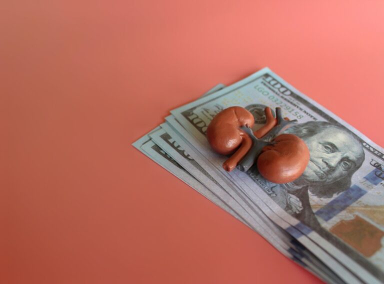 Selling kidneys to make ends meet - Medical Forum