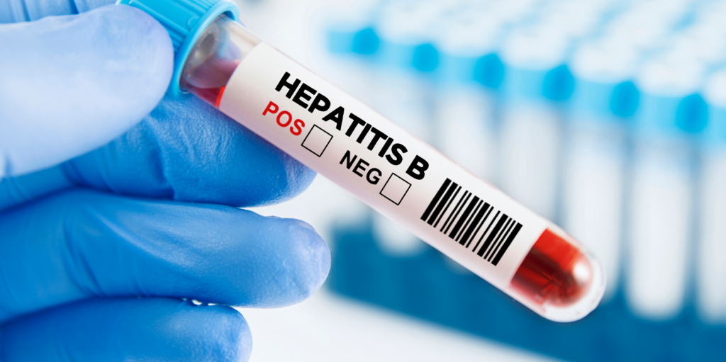 Empowering GPs with a new hepatitis B service