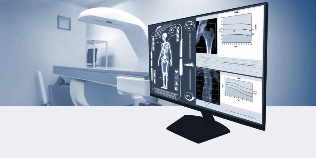 How AI can predict cardio events using bone scans
