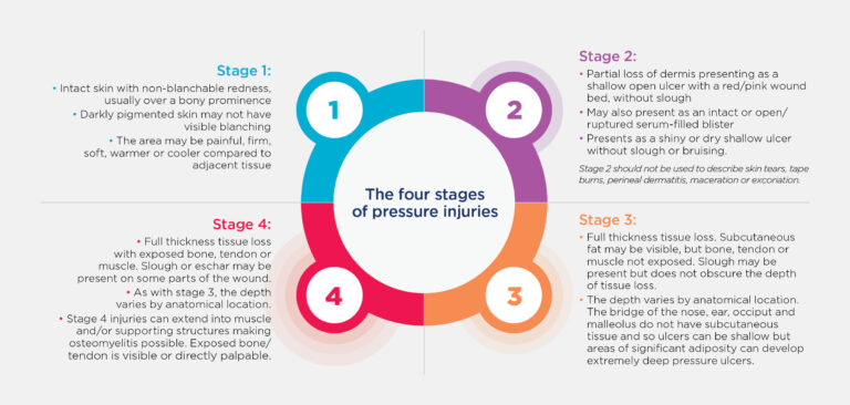 four stages of pressure injuries - Medical Forum