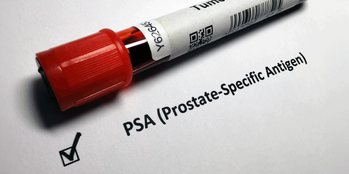 prostate cancer - Medical Forum