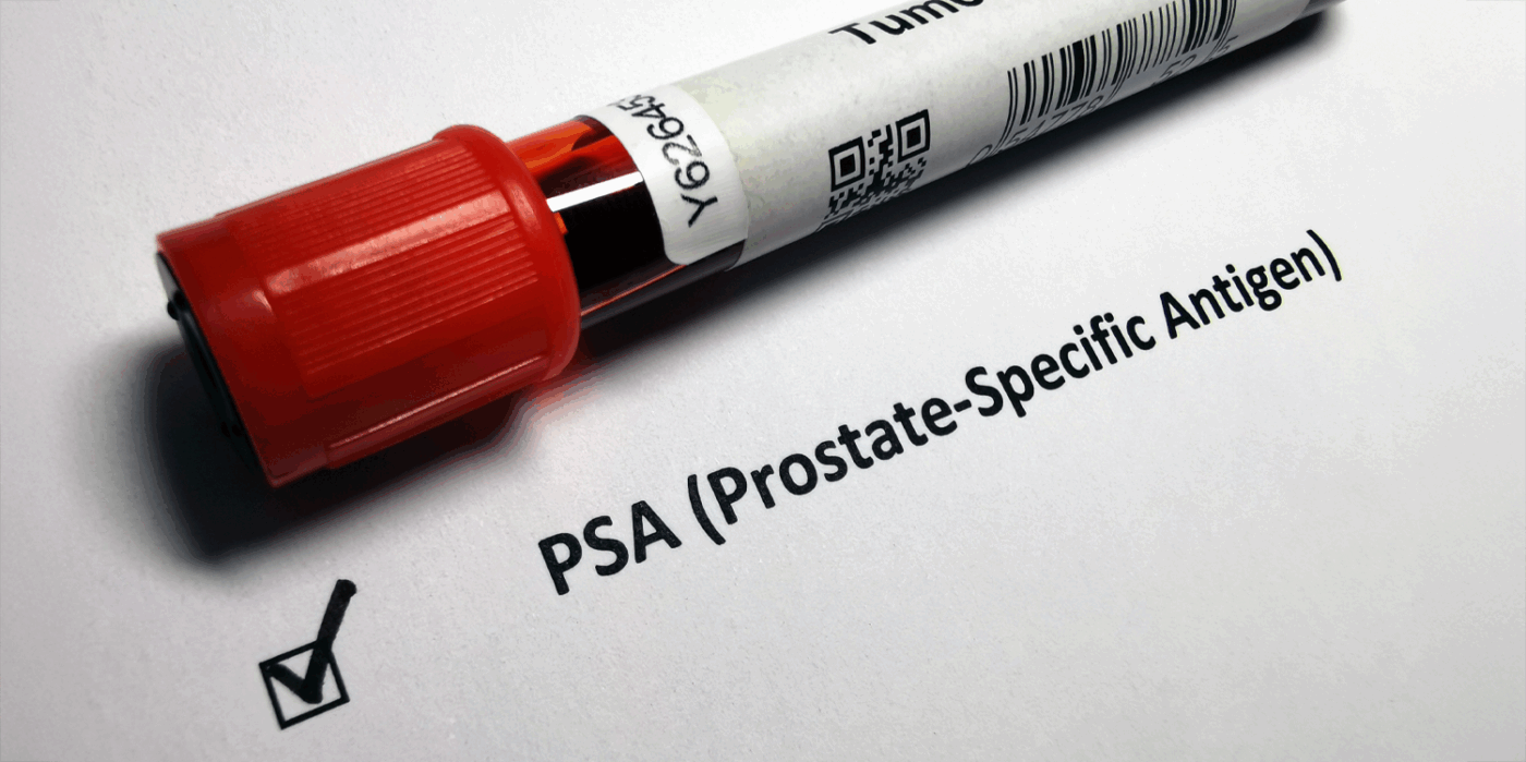 What to expect from new guidelines on detecting prostate cancer