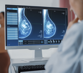 mammogram pd - Medical Forum