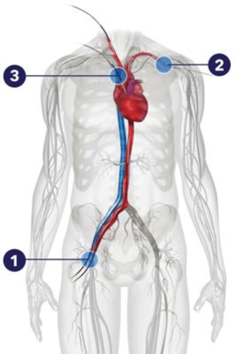 ‘Get out your stethoscope’ to catch aortic stenosis early