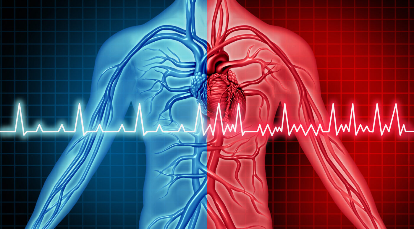 Earlier atrial fibrillation checks suggested for Indigenous Australians